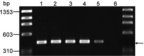 Adenoviruses Adv 434 Bp Amplicon Obtained By Polymerase Chain Download Scientific Diagram