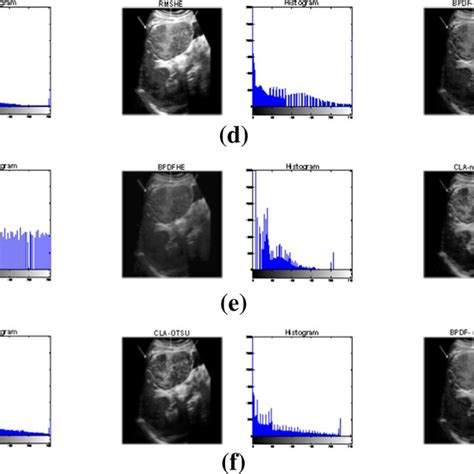 the simulation results of the proposed algorithm on ultrasound liver