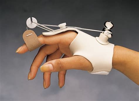 Splint Tuner Finger Flexion Extension Kit Hand Therapy Medical Illustration Ocupational Therapy