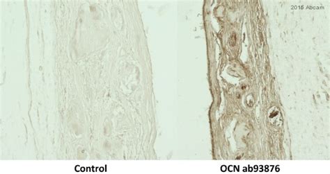 Osteocalcin抗体ab93876abcam中文官网