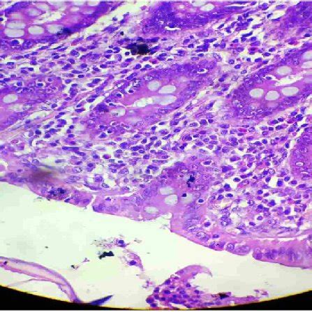 Showing Lymphoid Cells Within The Appendix Download Scientific Diagram