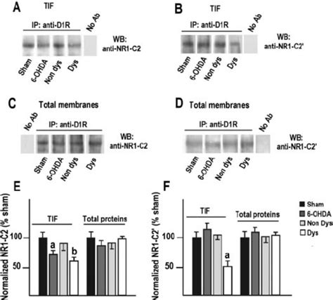 Effects Of L Dopa On The Interaction Between D1r And Nmdar In Download Scientific Diagram