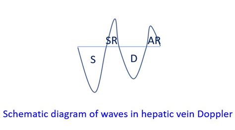 Assessment Of Right Ventricular Diastolic Function All About Cardiovascular System And Disorders