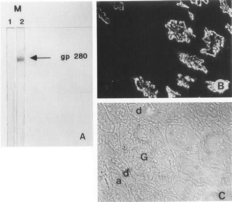 Immunolocalization Ofhuman Gp280 In Renal Cortex Using Monoclonal