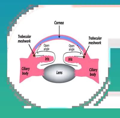 Primary Open Angle Glaucoma Causes Diagnosis Treatment