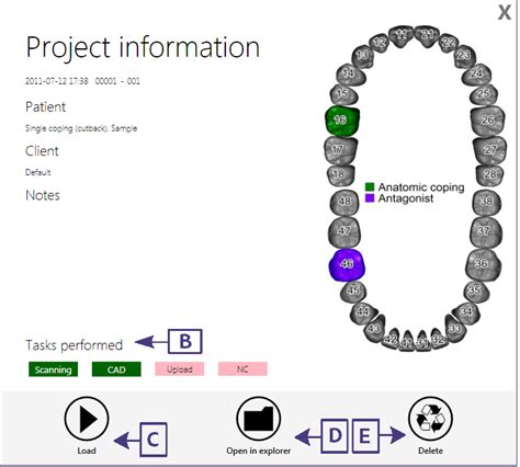Loading Jobs New UI Exocad