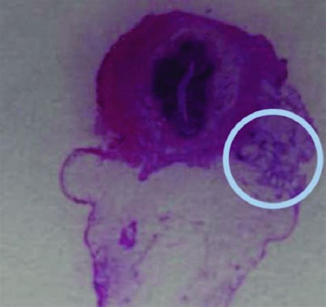 No Neoplastic Finding Was Observed In The Mucosal Layers Of The Download Scientific Diagram