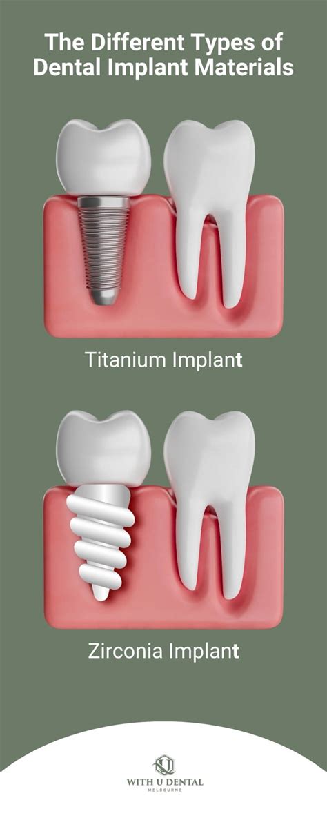 Types Of Dental Implants Pictures
