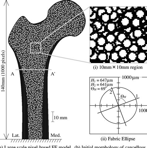 Computational Simulation Model For Trabecular Surface Remodeling In The