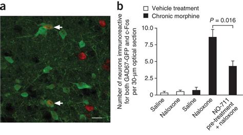 Gat 1 Inhibition Reduced Gabaergic Pag Neuron Excitability In Vivo A
