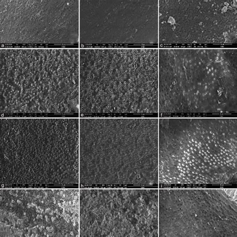 scanning electron microscope micrographs showing smear layer removal at