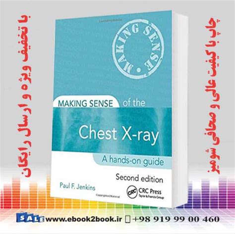 Making Sense Of The Chest X Ray A Hands On Guide 2nd Edition فروشگاه