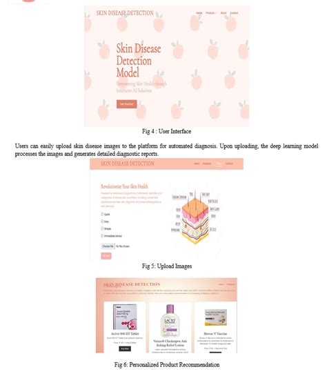 Skin Disease Detection Model