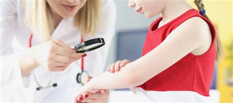 Наконец появилось лекарство от моллюска вирусной кожной болезни у детей и взрослых Рецепты