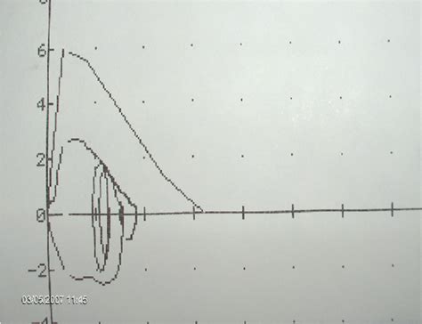 Spirometric Pulmonary Function Curves Download Scientific Diagram