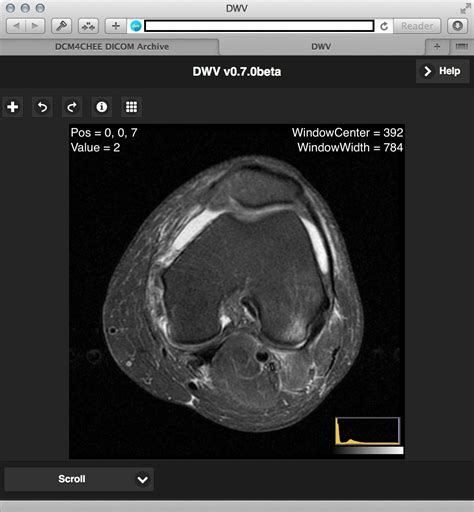 5 Dicom Viewers For Any Practice