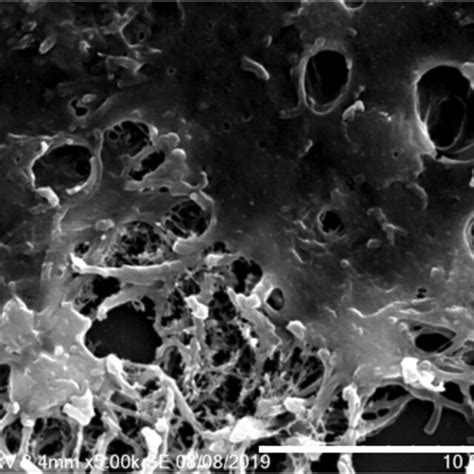 Sem Image Of L Prf Demonstrating Food Interfibrillar Space With A Very