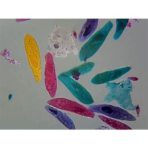 Prepared Microscope Slide Mixed Protozoa Slide