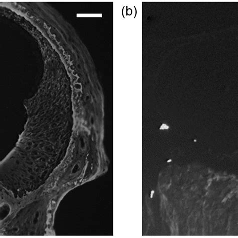 Image Of An Unstained Cross Section Through The Lower Basal Cochlear