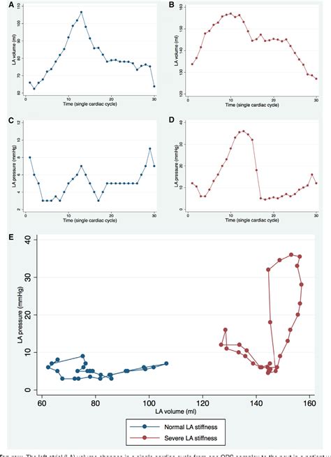 Figure 1 From Association Between Left Atrial Stiffness Index And