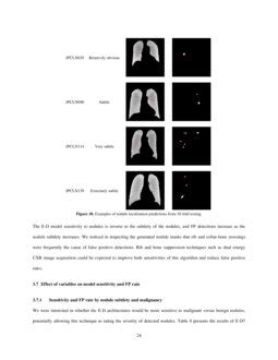 Full Resolution Lung Nodule Segmentation From Chest X Ray Images Using