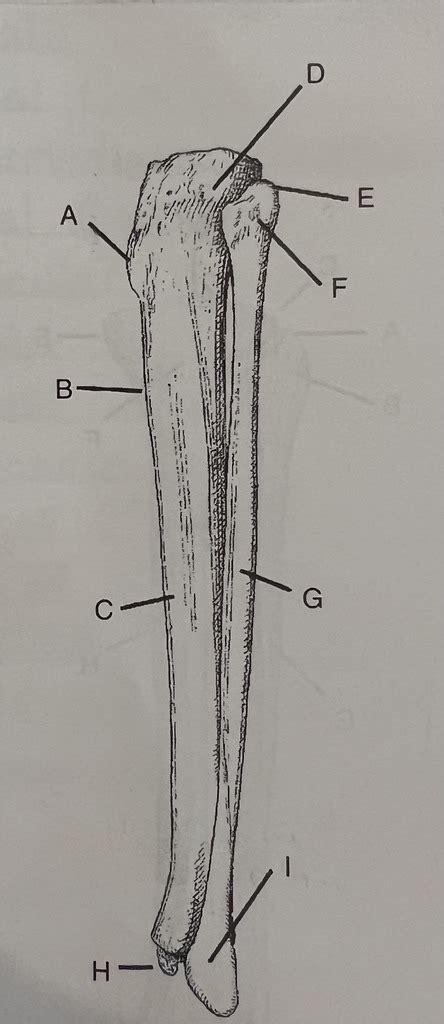 Lateral Tibia And Fibula Diagram Quizlet