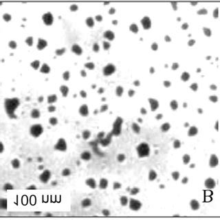 Transmission Electron Microscopy Images Of A SiO 2 NPs B Ag NPs Download Scientific