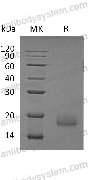 Buy Recombinant Human Acvr1 Protein C His