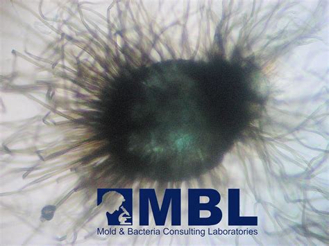 Chaetomium A Damp Fungus Jackson Kungu Phd Posted On The Topic