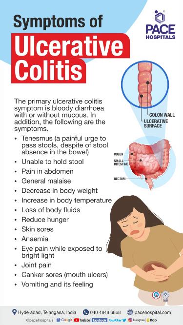 Best 13 Anal Fistula Symptoms Causes Types Complications