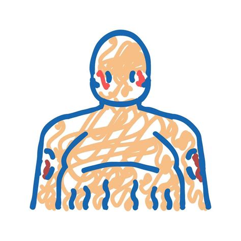 Cushing Disease Endocrinology Icon Doodle Illustration 62451988 Vector