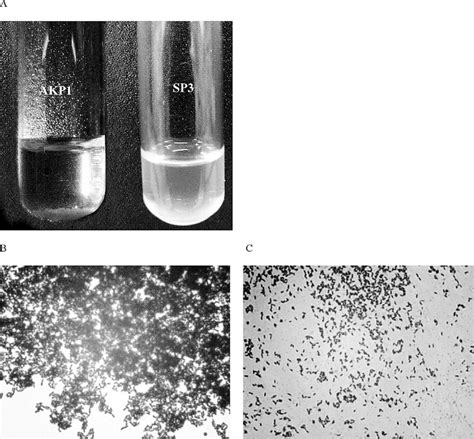 Macroscopic And Microscopic Views Of Autoagglutinating Download Scientific Diagram