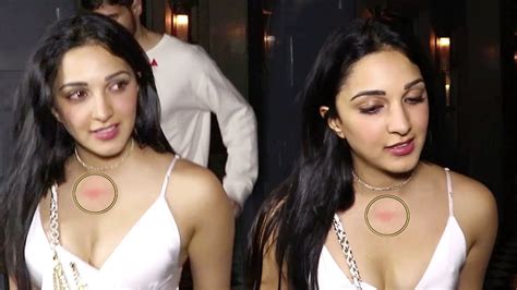 Neck Bite Marks