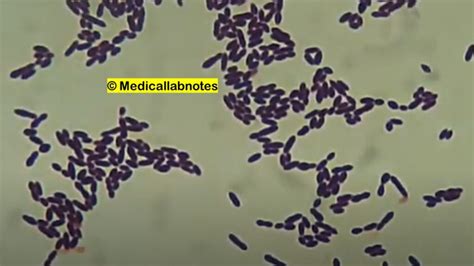 Enterococcus Durans Introduction Classification Morphology