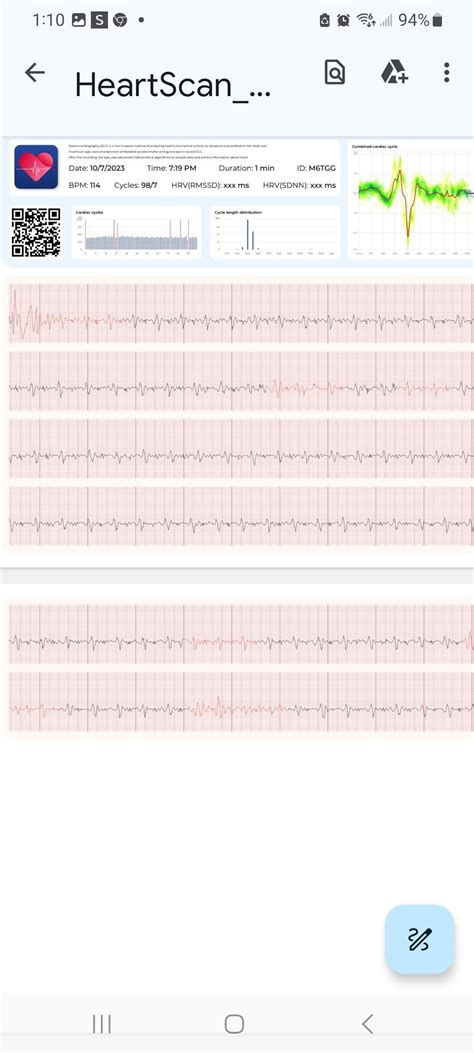Afib R Readmyecg