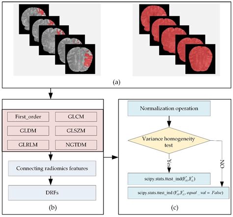 The Combination Of Whole Brain Features And Local Lesion Features In Dsc Pwi May Improve
