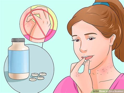 How To Cure Scabies 15 Steps With Pictures Wikihow