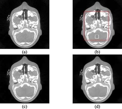 Figure 1 From Statistical Iterative Cbct Reconstruction Based On Neural