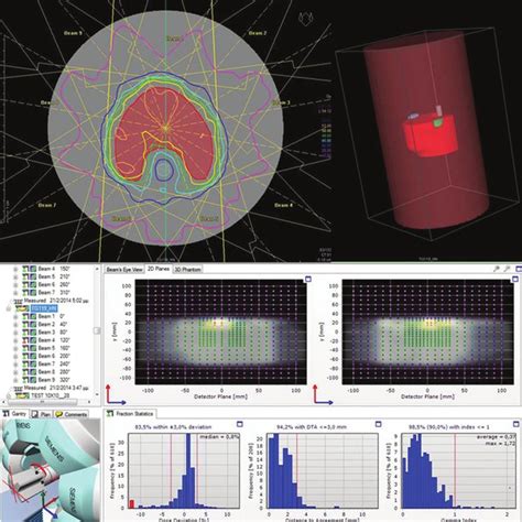 Dose Distribution Dose Deviation Distance To Agreement And Gamma Download Scientific Diagram