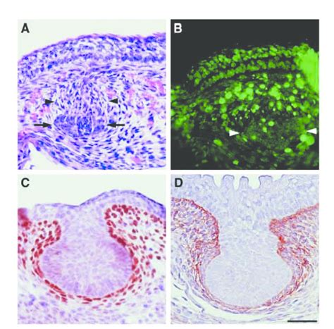 Return Of Sexual Dimorphism In K14 PTHrP PTHrP Null Embryos A Download Scientific Diagram