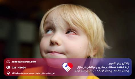 علت قرمزی چشم کودک درمان قرمز شدن چشم نوزاد