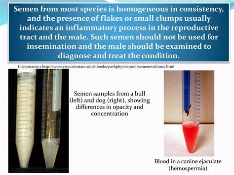 Sperm Countpptx Infertility Reproductive Health