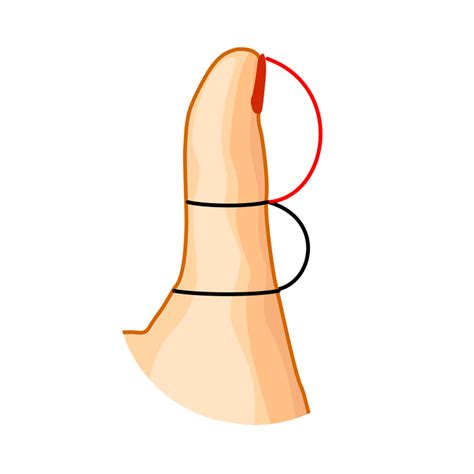 Эрүүл Хэрвээ таны эрхий хуруу В хэлбэртэй харагдаж байвал Хэрвээ таны эрхий хурууны дээд