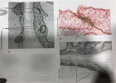 Transmission Electron Micrographs Of Capillary Walls 29 6 Diagram Quizlet