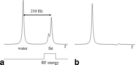 Fat And Water Magnetic Resonance Imaging Bley 2010 Journal Of