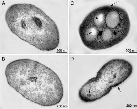 Scielo Brasil Cupriavidus Necator Strains Zinc And Cadmium Tolerance And Bioaccumulation
