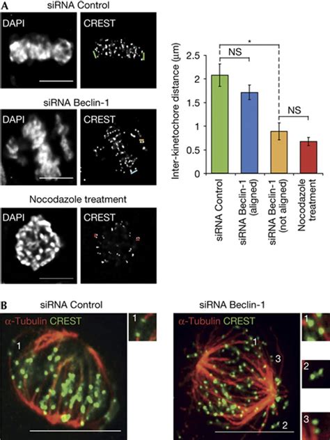 Beclin 1 Is Required For Chromosome Congression And Proper Outer Kinetochore Assembly Pmc