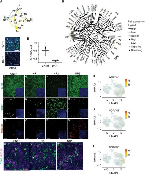 Figure 5 From Single Cell Reconstruction Of Human Basal Cell Diversity In Normal And Ipf Lung