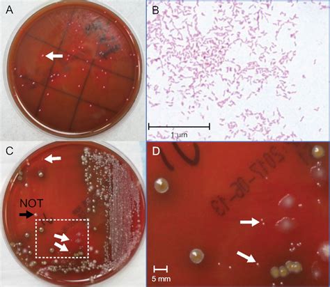 Culture Methods To Determine The Limit Of Detection And Survival In