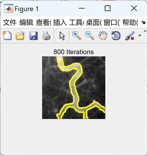 【局部活动轮廓】使用水平集方法实现局部活动轮廓方法研究（matlab代码实现） 知乎